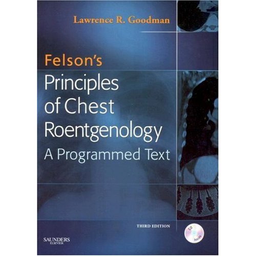 Jeffrey Dach MD » Remembering Benjamin Felson, M.D.